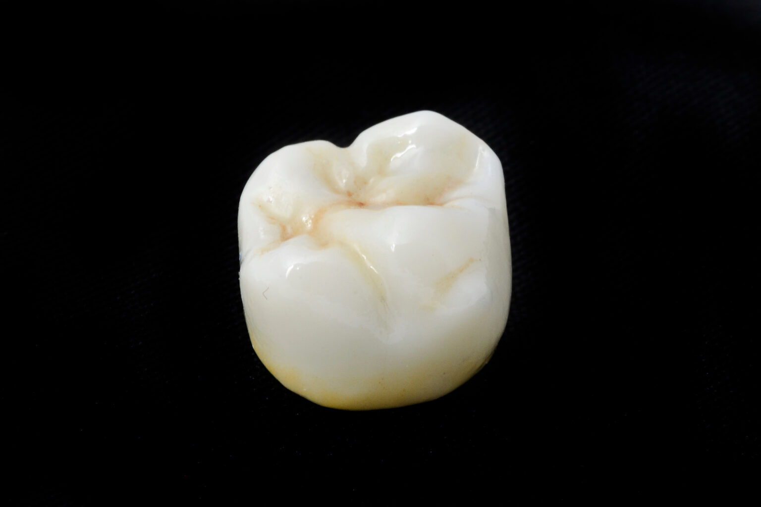 Same-Day Cosmetic Dental Crowns | Rochester, MN