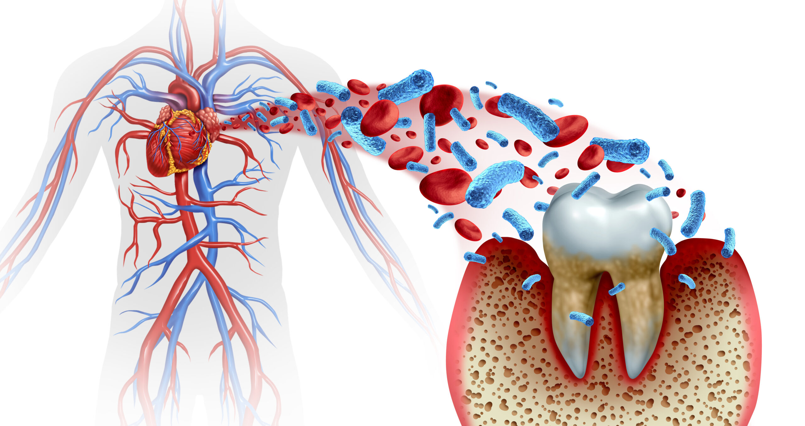 Bleeding Gums Are a Warning Sign | Rochester, MN