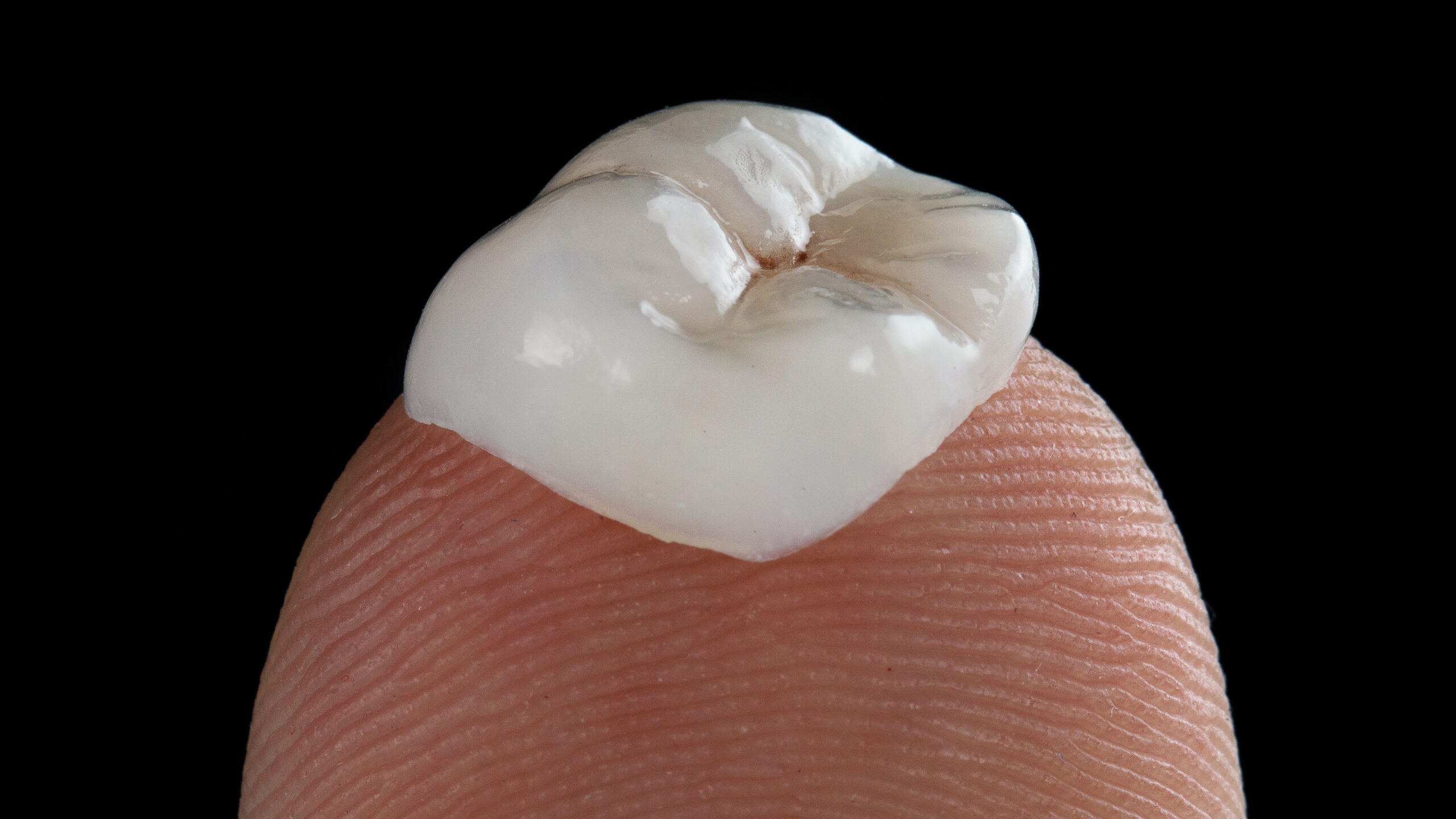 Helping Your Smile With Same-Day Crowns | Rochester, MN